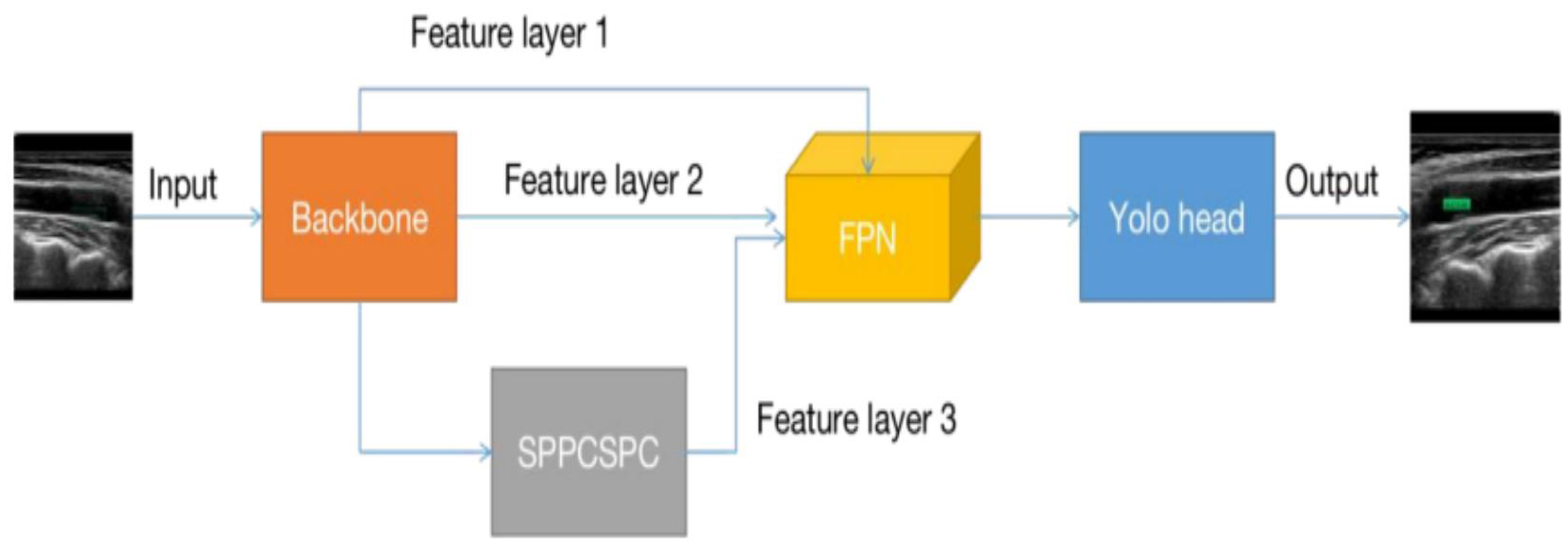 Deep Learning-Based Carotid Plaque Ultrasound Image Detection and Classification Study
